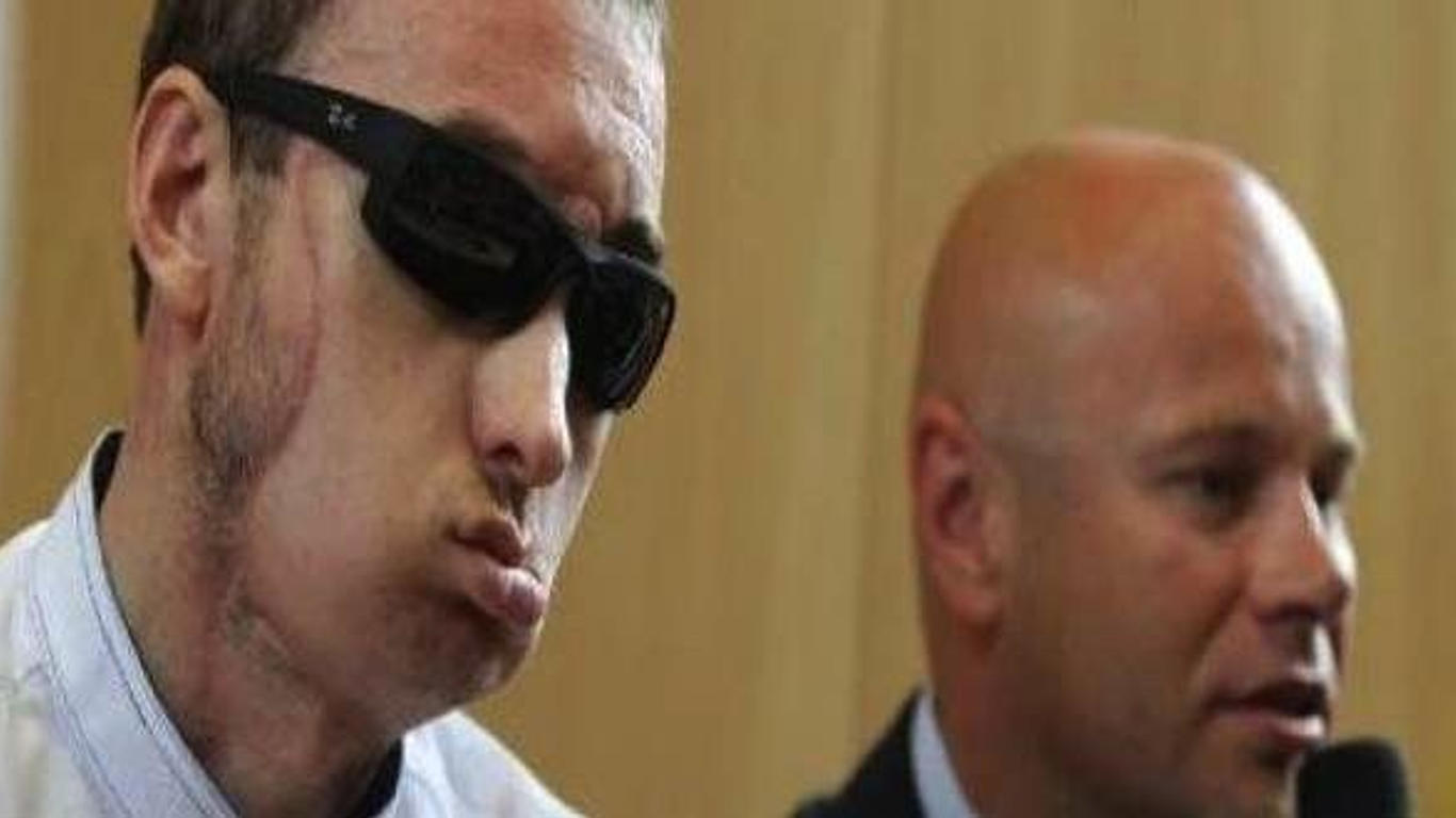 Le premier greffé du visage en urgence est sorti de l'hôpital ...