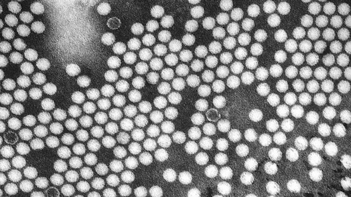 Poliomyélite : l'OMS décrète l'urgence de santé publique - AlloDocteurs