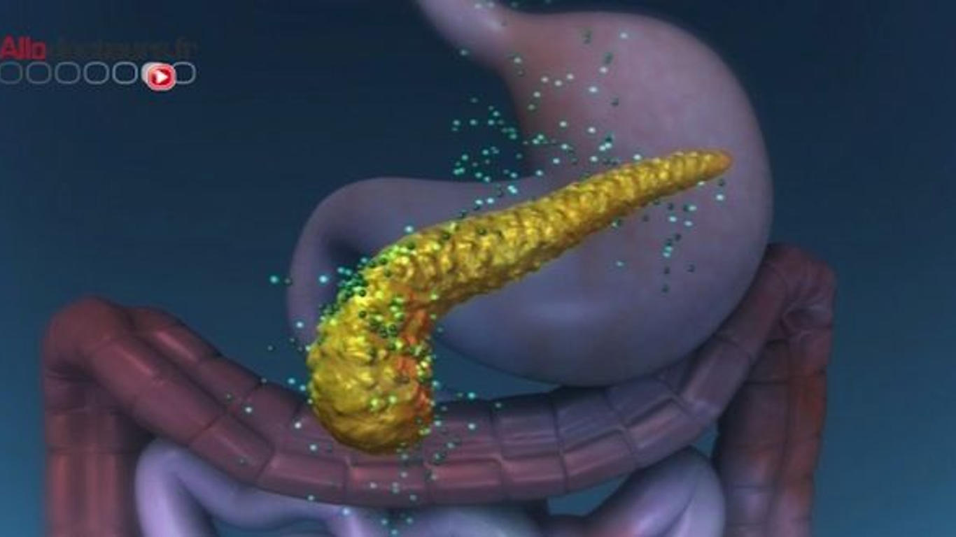 Cancer du pancréas : l'un des cancers les plus redoutés - AlloDocteurs