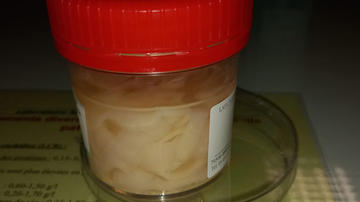 Vers intestinaux, Oxyurose - AlloDocteurs