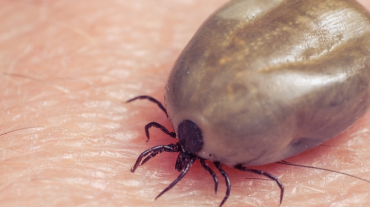 Piqûre de tique - AlloDocteurs