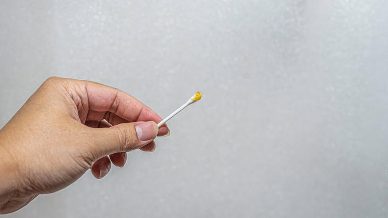 Bouchon de cérumen - AlloDocteurs