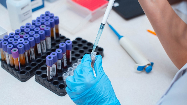 Traitements du cancer - AlloDocteurs