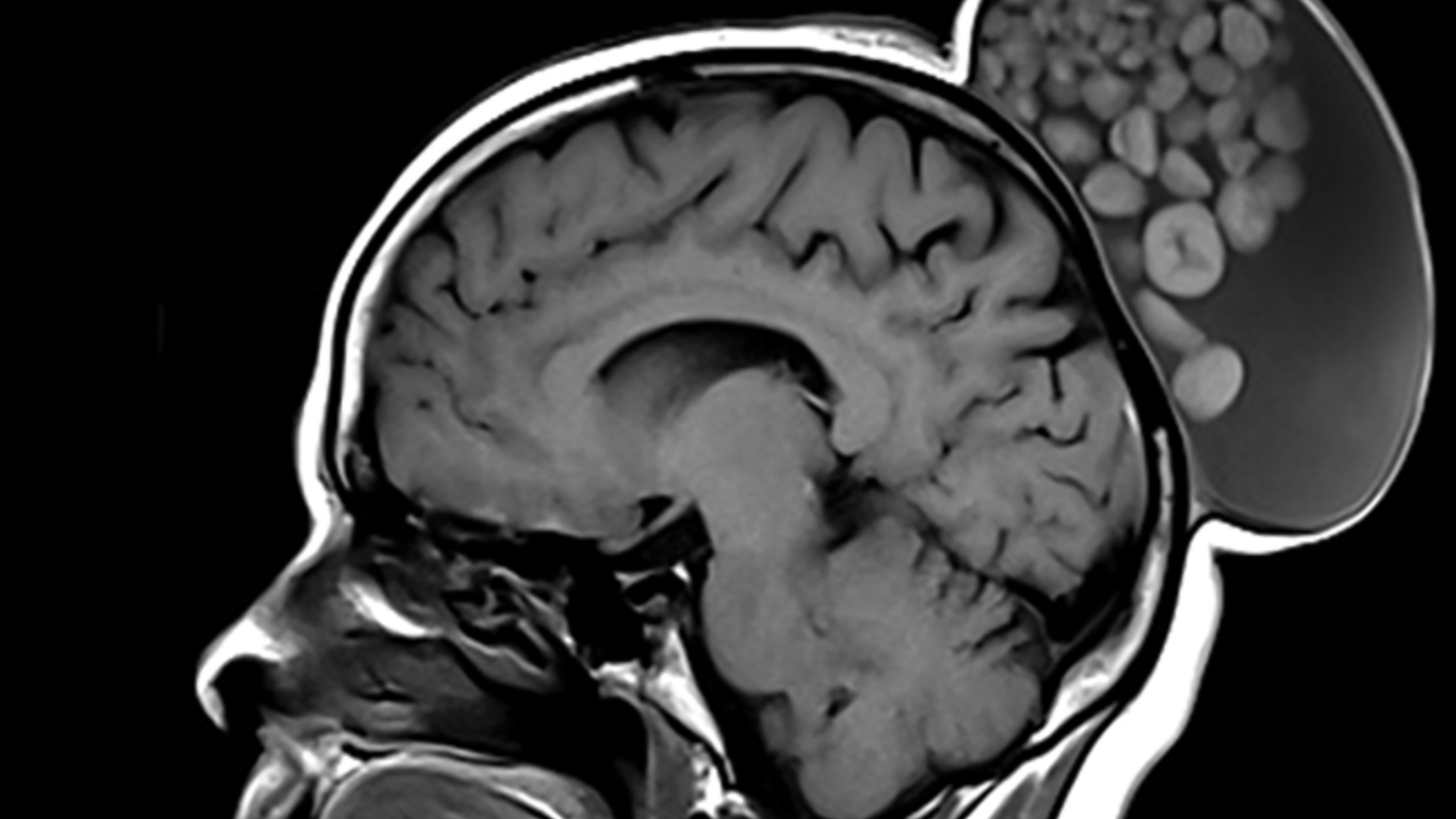 Elle se rend aux urgences, les médecins lui retirent un kyste de 15 cm ...