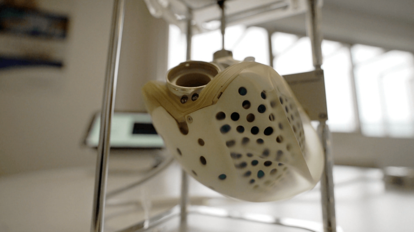 Comment fonctionne le cœur artificiel Carmat ? - AlloDocteurs