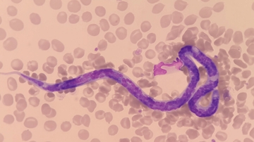 Vers intestinaux - AlloDocteurs