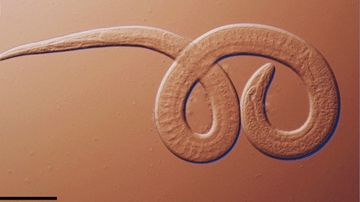 Vers intestinaux - AlloDocteurs