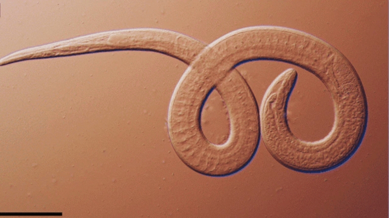 Vers intestinaux - AlloDocteurs