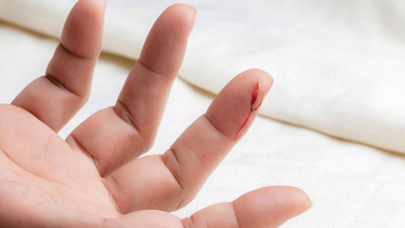 Quels sont les premiers soins à faire en cas de coupure ? - AlloDocteurs