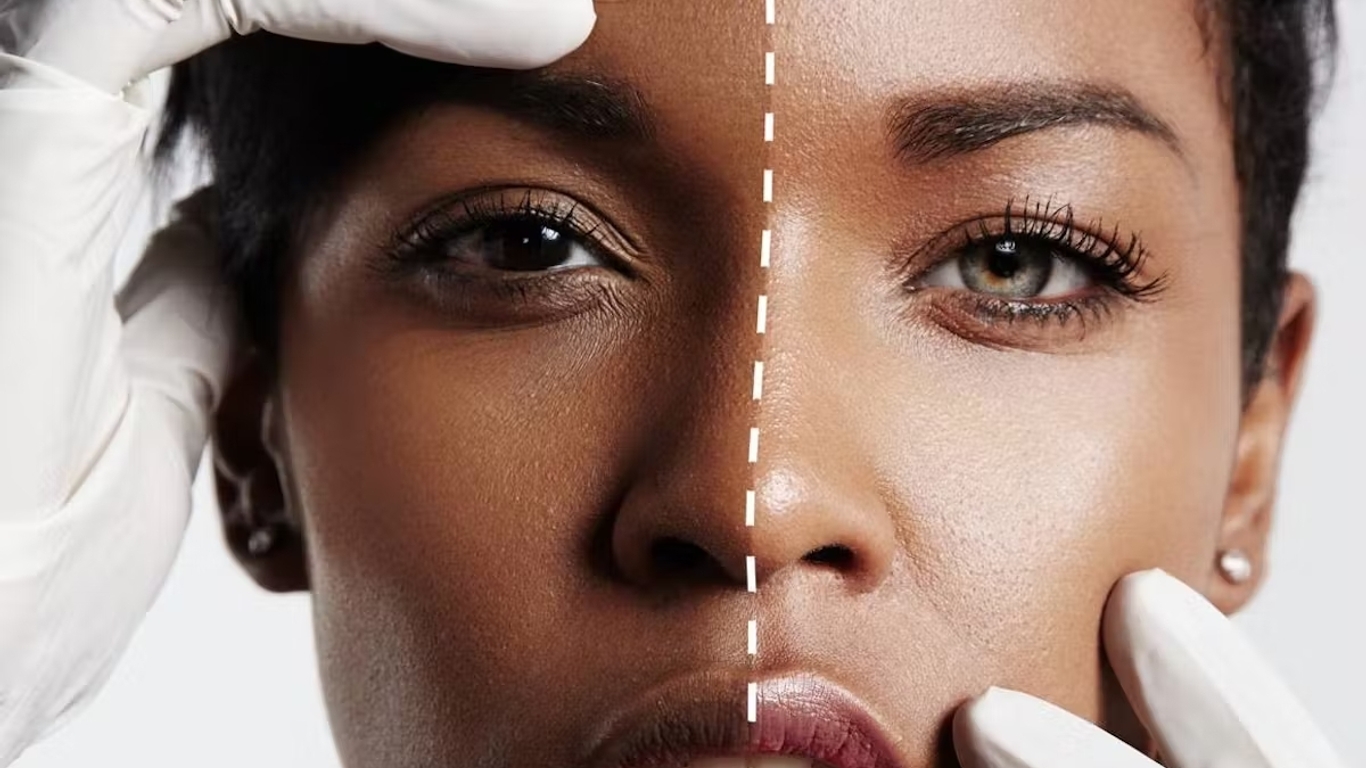 Le Cameroun, toujours accro aux produits pour se blanchir la peau ...