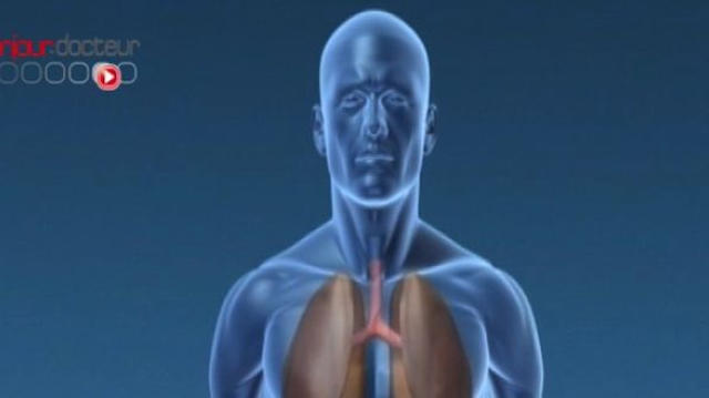 Infection opportuniste - AlloDocteurs