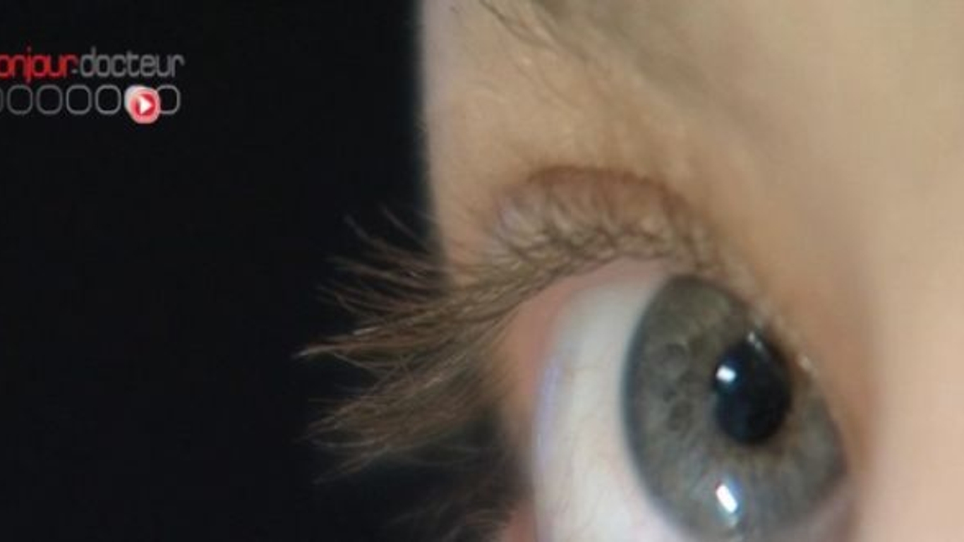 Un regard pour la recherche sur les maladies de l'oeil - AlloDocteurs