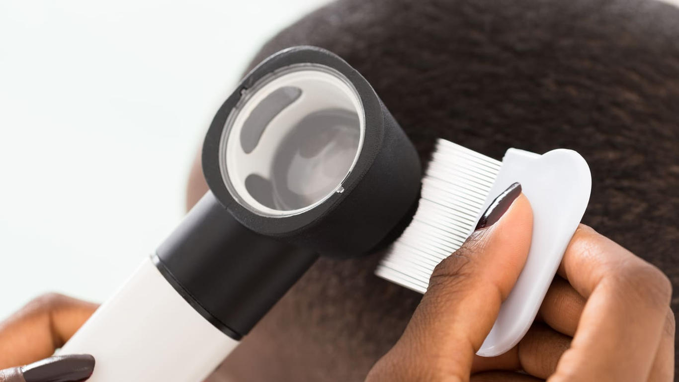 Comment savoir si votre enfant a des poux ? - Allo Docteurs